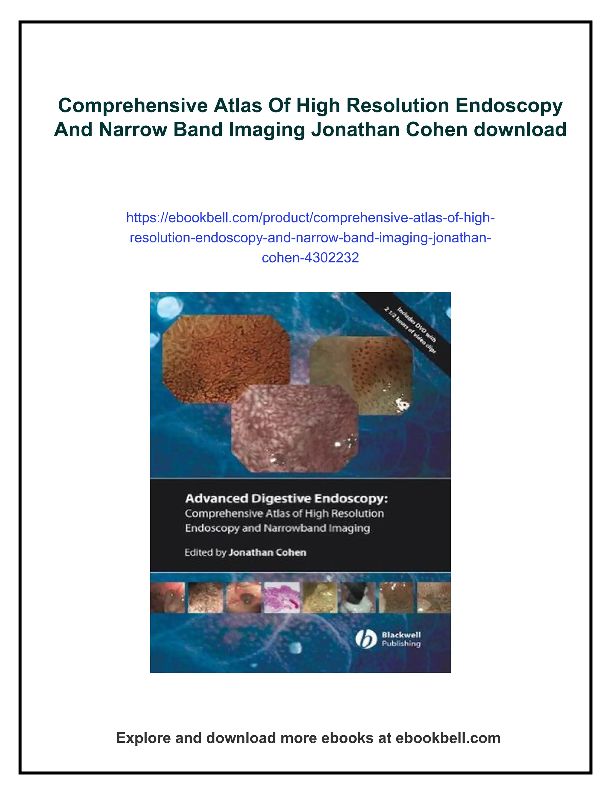 Comprehensive Atlas Of High Resolution Endoscopy And Narrow Band Imaging Jonathan Cohen | PDF