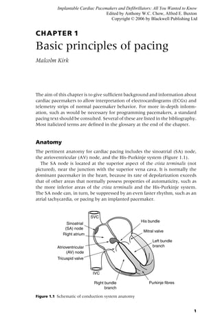 Implantable Cardiac Pacemakers And Defibrillators All You Wanted To ...