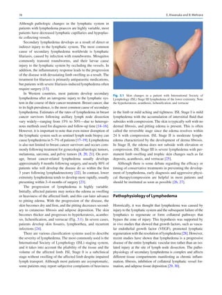 Multimodal Management Of Upper And Lower Extremity Lymphedema Mark V ...