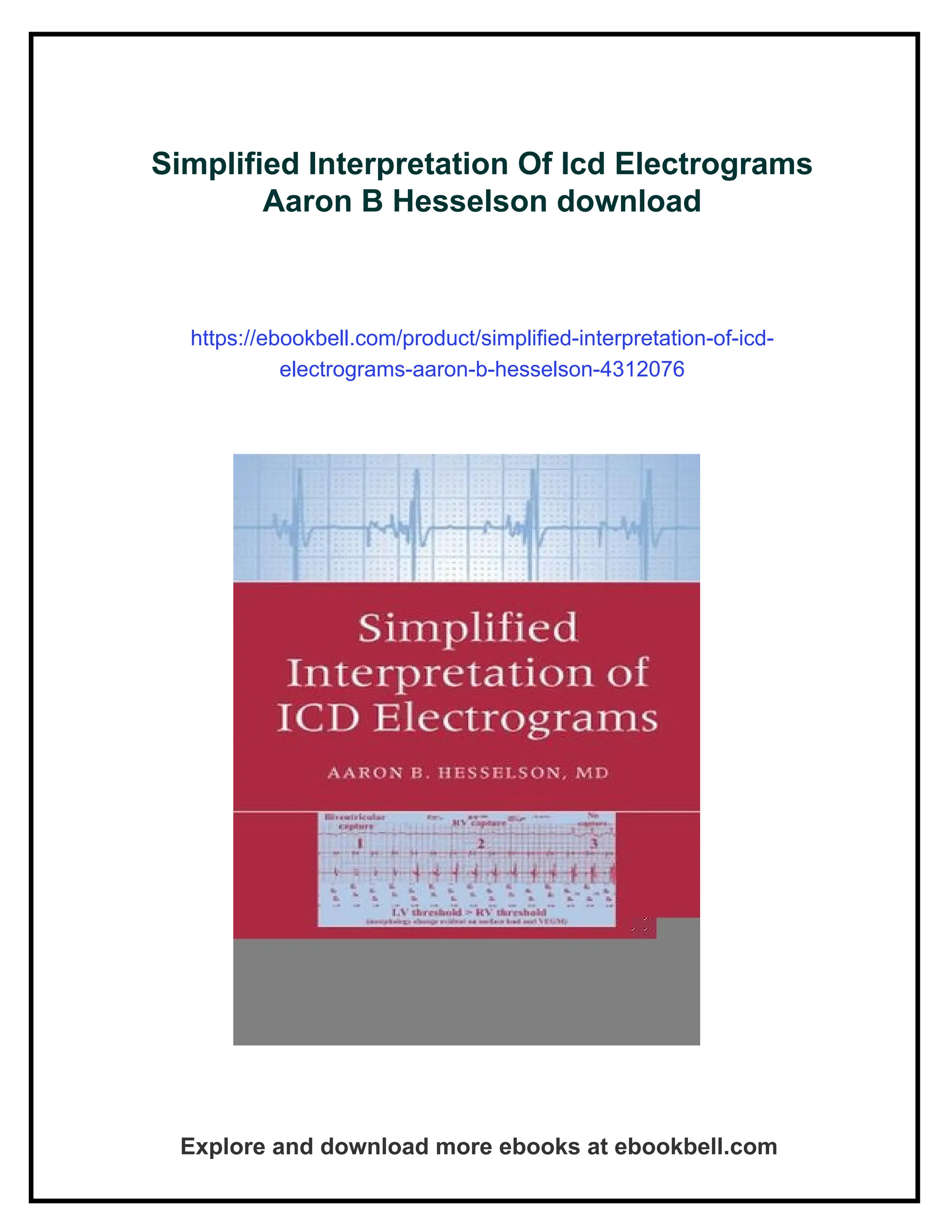 Simplified Interpretation Of Icd Electrograms Aaron B Hesselson | PDF