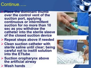 218935884-16744678-Safe-Suctioning.ppt
