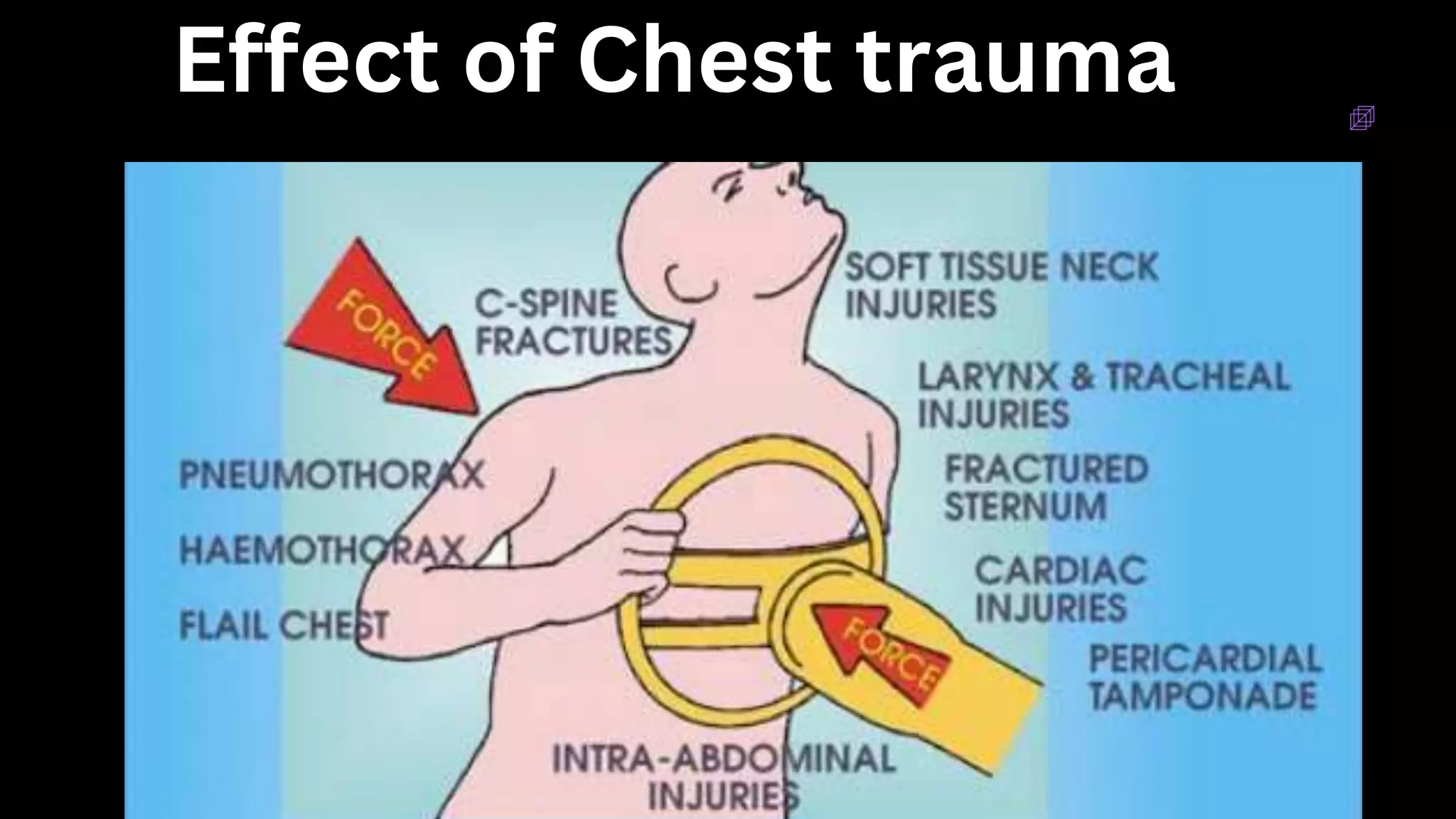 Introduction to the Torso Trauma | PPTX