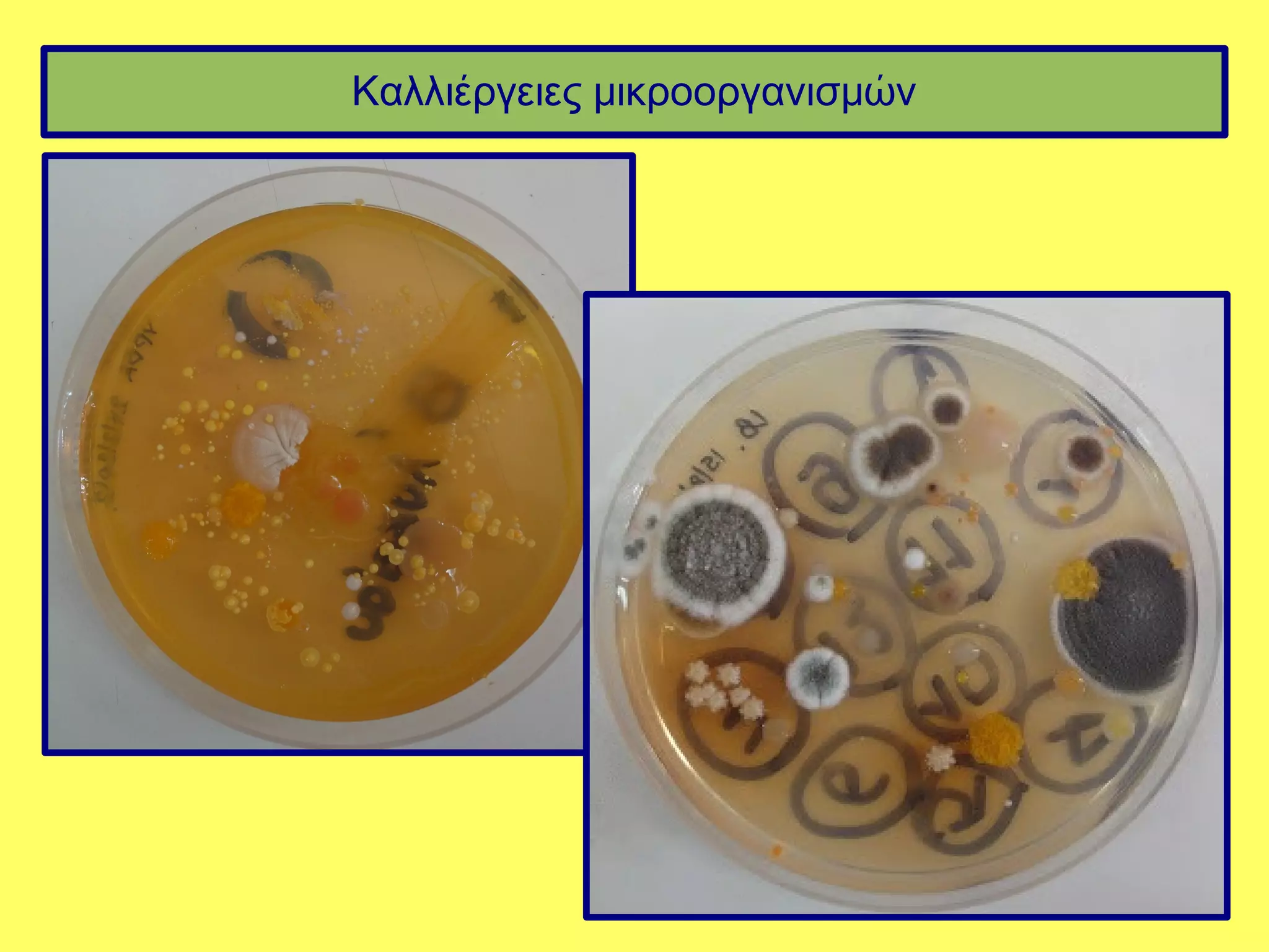 Μετάδοση και αντιμετώπιση μικροοργανισμών | ODP
