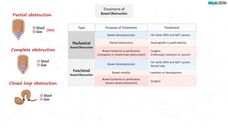 Gastro intestinal Bowel Obstruction [Slides].pdf