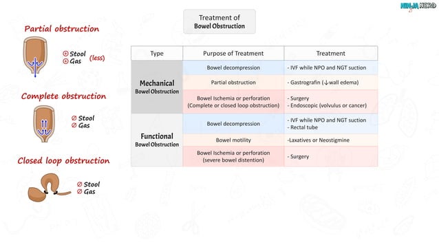Gastro intestinal Bowel Obstruction [Slides].pdf