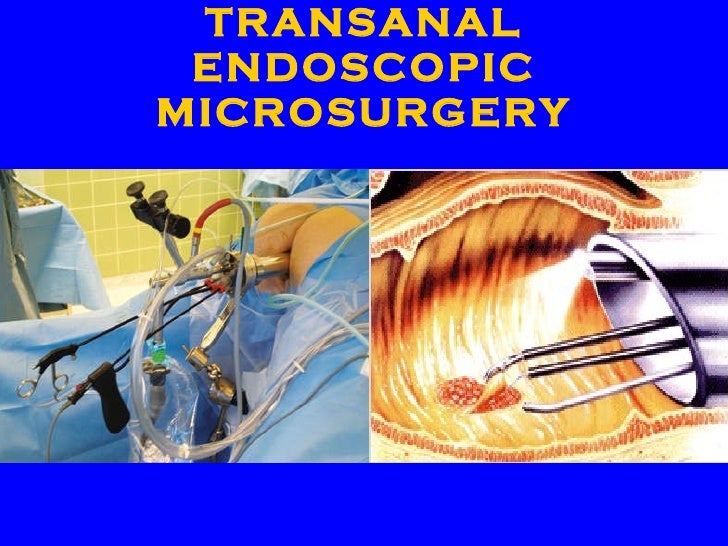 21 Century Management Of Colorectal Cancer