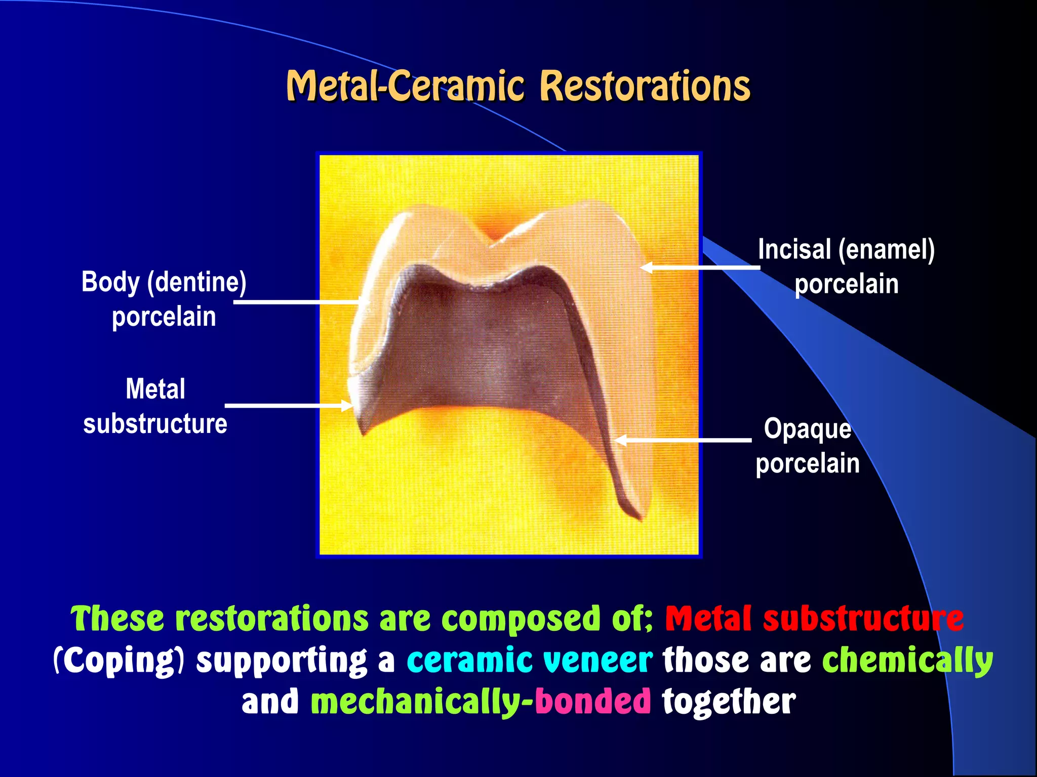 DENTAL CERAMICS Dental Porcelain All-CERAMIC RESTORATIONS dental ...