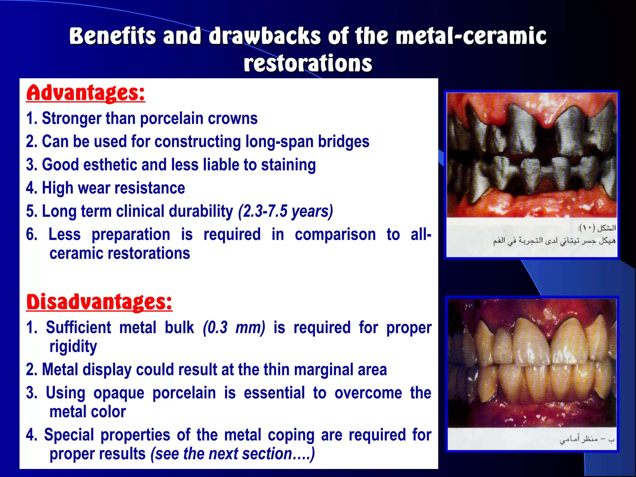 DENTAL CERAMICS Dental Porcelain All-CERAMIC RESTORATIONS dental ...