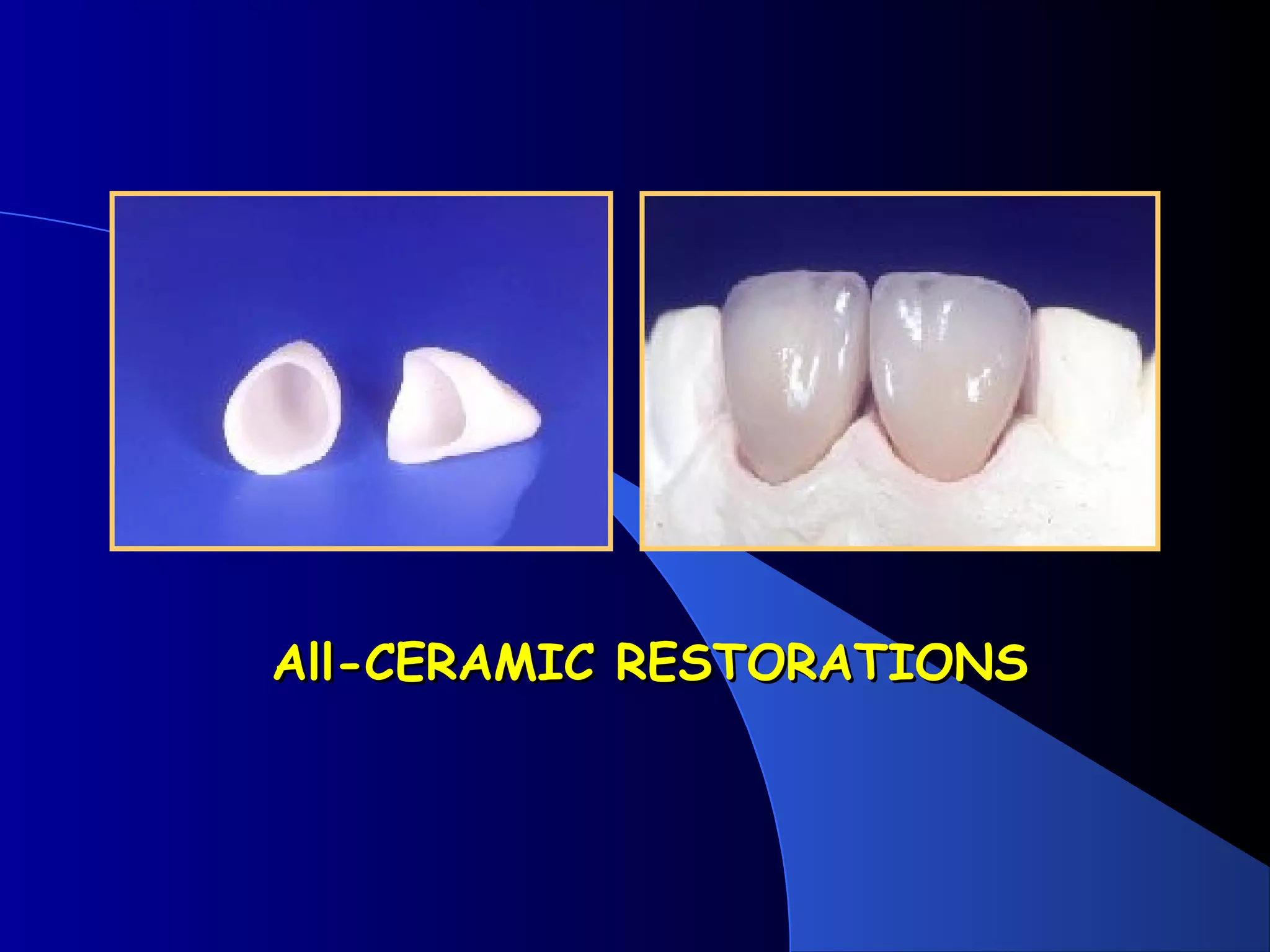 DENTAL CERAMICS Dental Porcelain All-CERAMIC RESTORATIONS dental ...