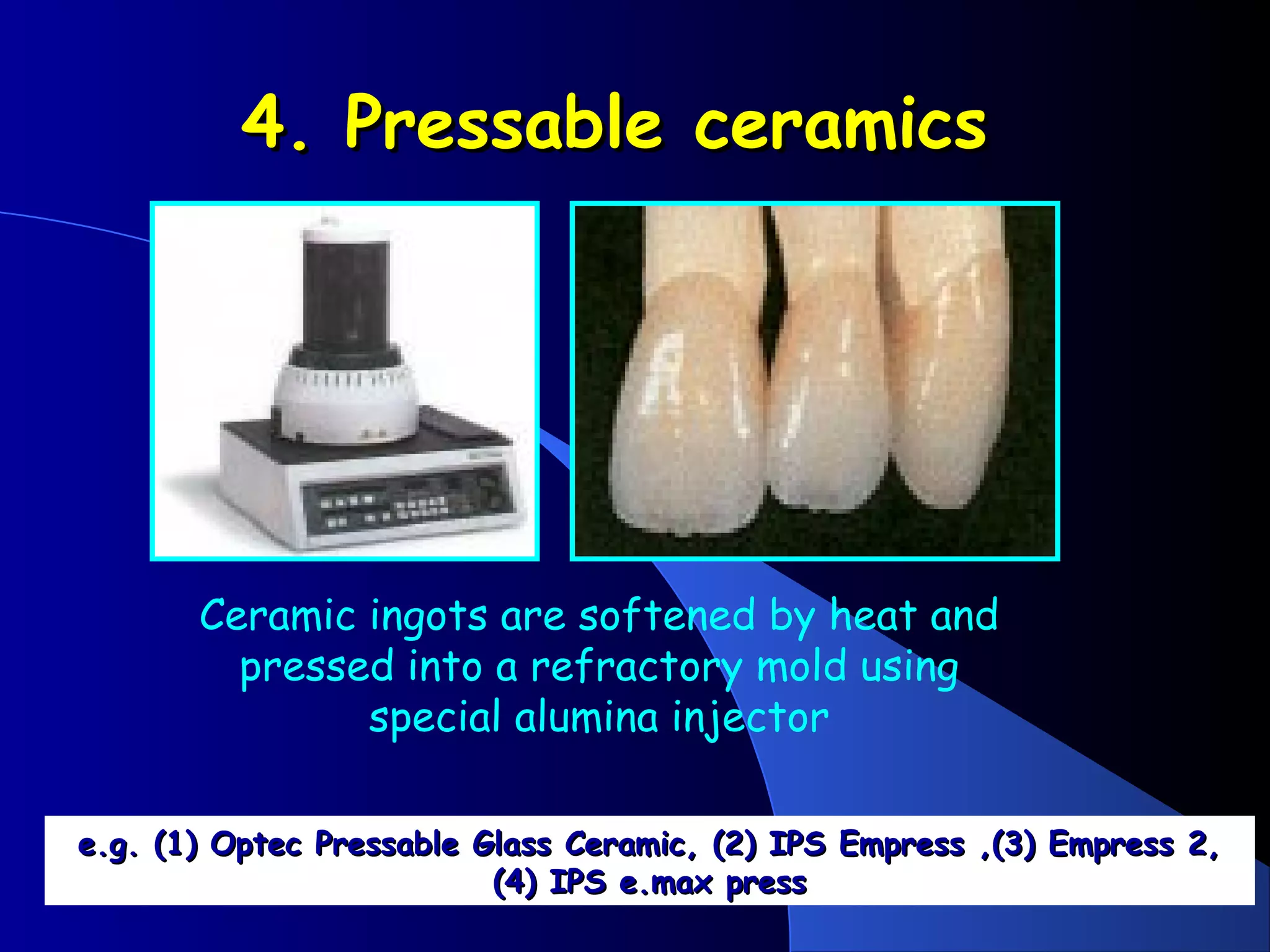 DENTAL CERAMICS Dental Porcelain All-CERAMIC RESTORATIONS dental ...