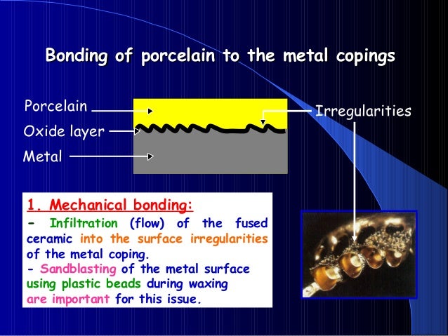 DENTAL CERAMICS Dental Porcelain All-CERAMIC RESTORATIONS dental mate…