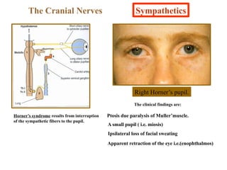 21. Anatomy of the cranial Nerves-1.pptx