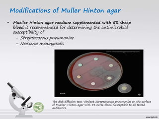 PRACTICAL antibiotic sensitivity test | PPT