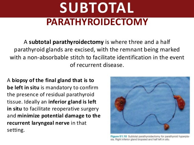 Management of Parathyroid disoders