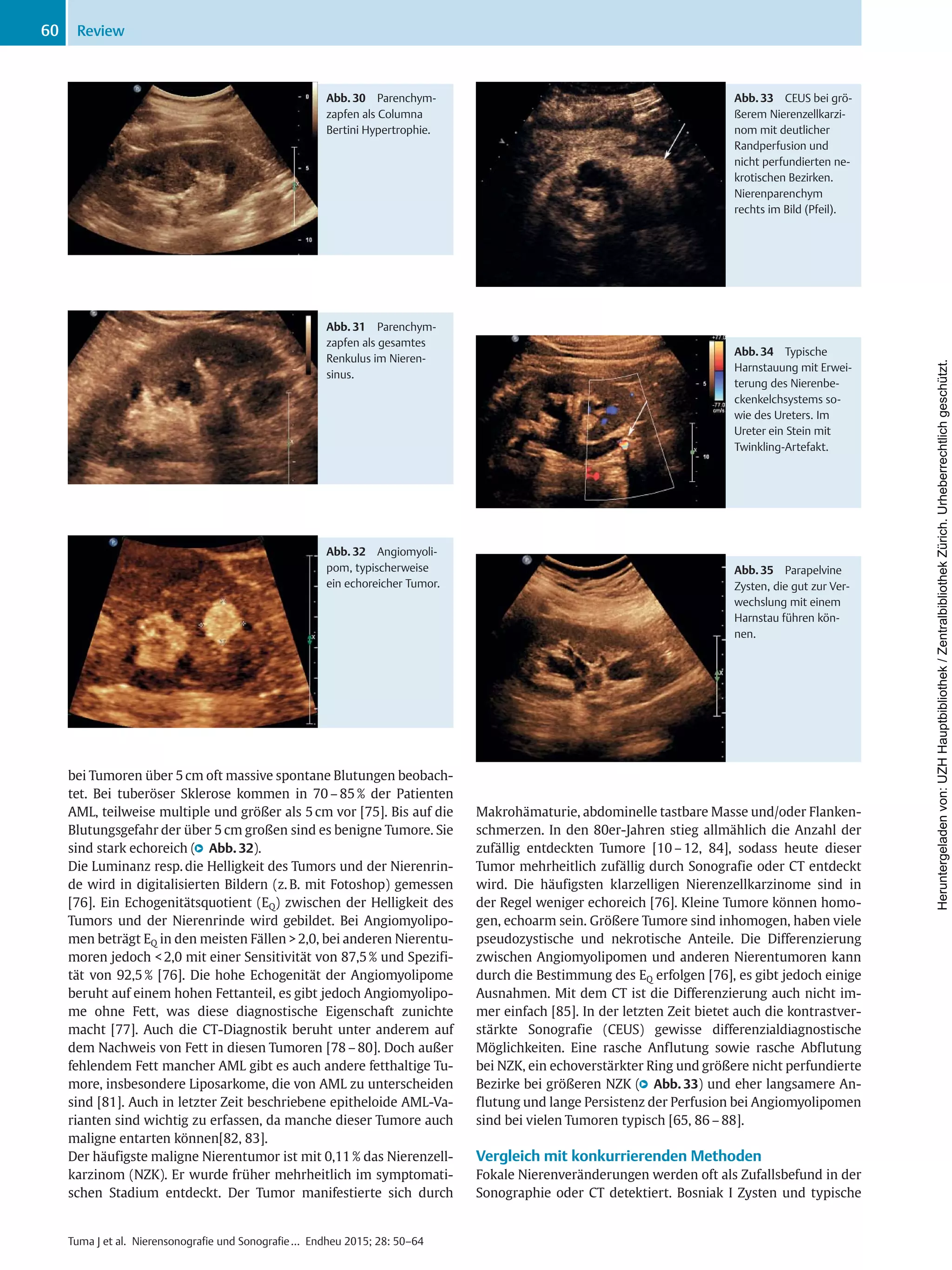 21 Sonographie der Niere und ableitenden Harnwegen. Allgemeinen ...