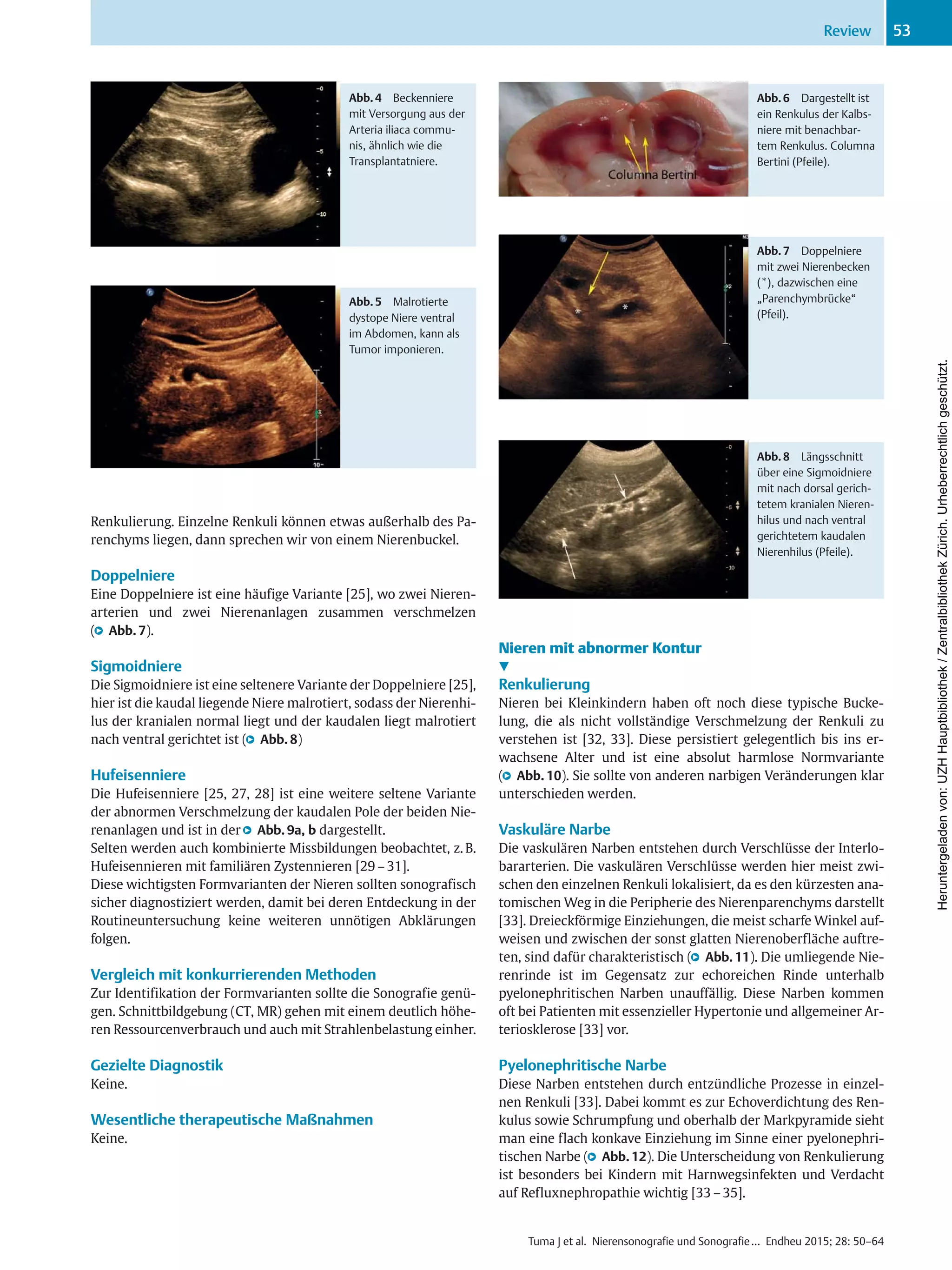 21 Sonographie der Niere und ableitenden Harnwegen. Allgemeinen ...