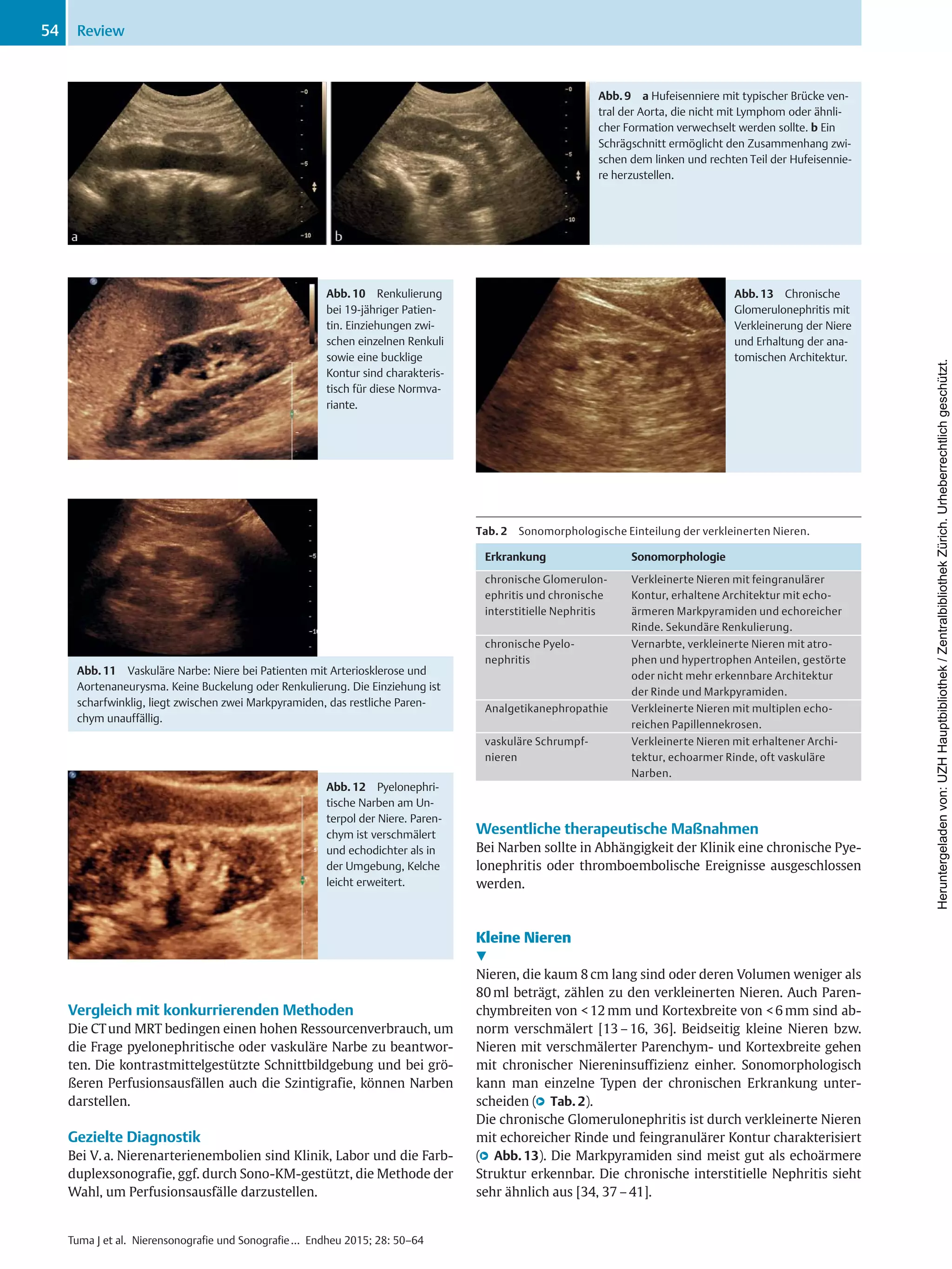 21 Sonographie der Niere und ableitenden Harnwegen. Allgemeinen ...
