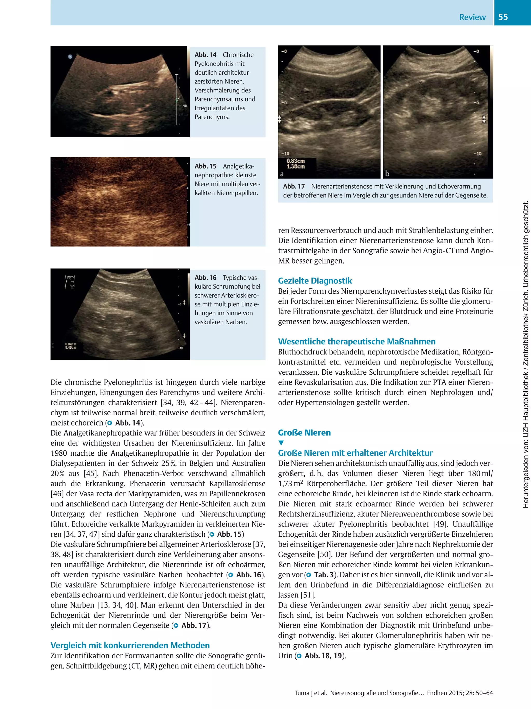21 Sonographie der Niere und ableitenden Harnwegen. Allgemeinen ...