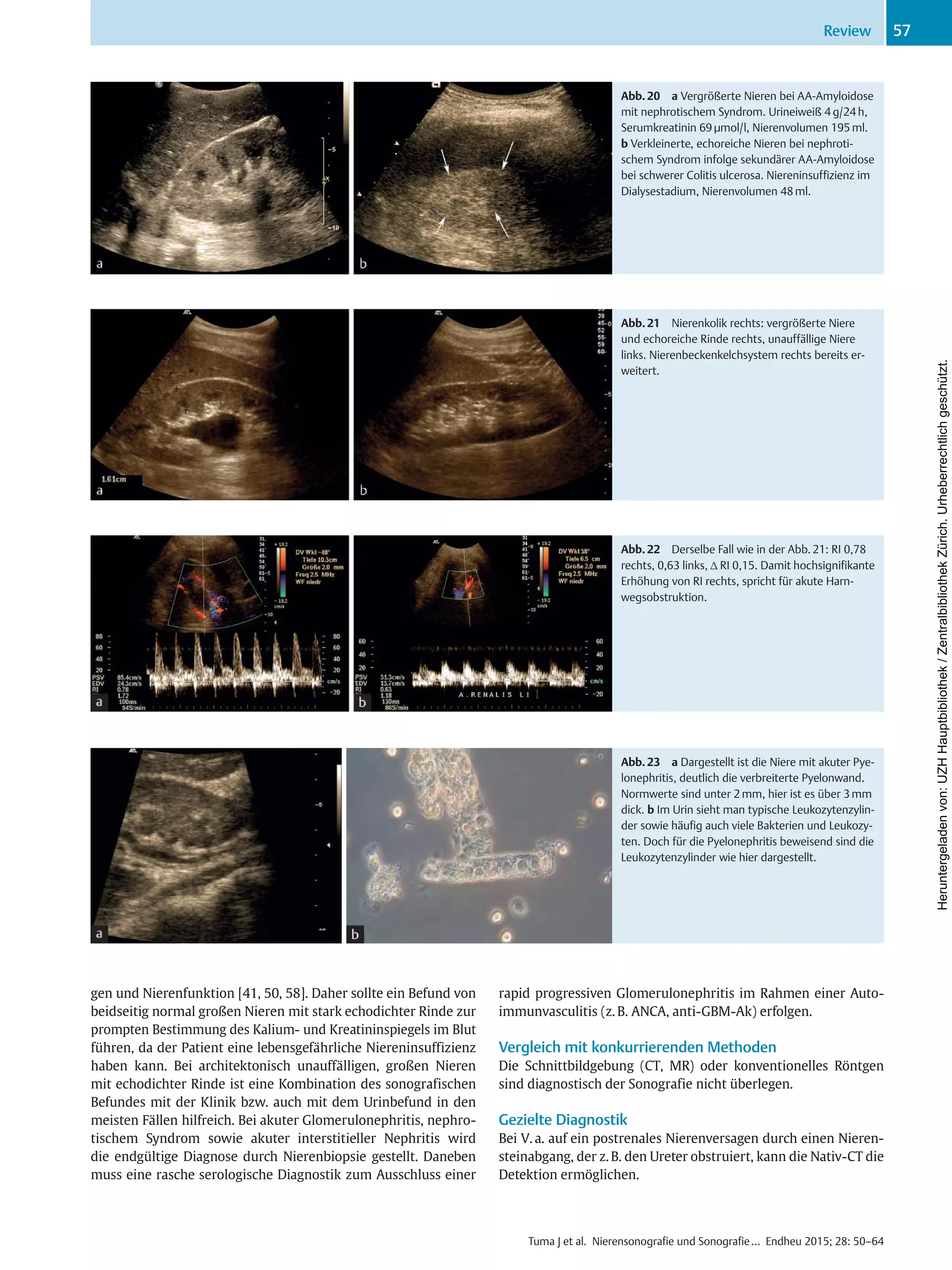 21 Sonographie der Niere und ableitenden Harnwegen. Allgemeinen ...