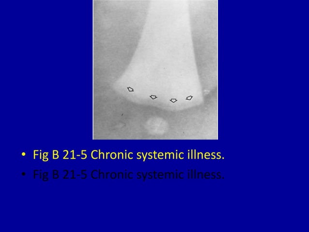 21 radiolucent metaphyseal bands | PPTX | Bone and Joint Conditions | Diseases and Conditions