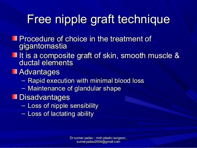 reduction mammoplasty