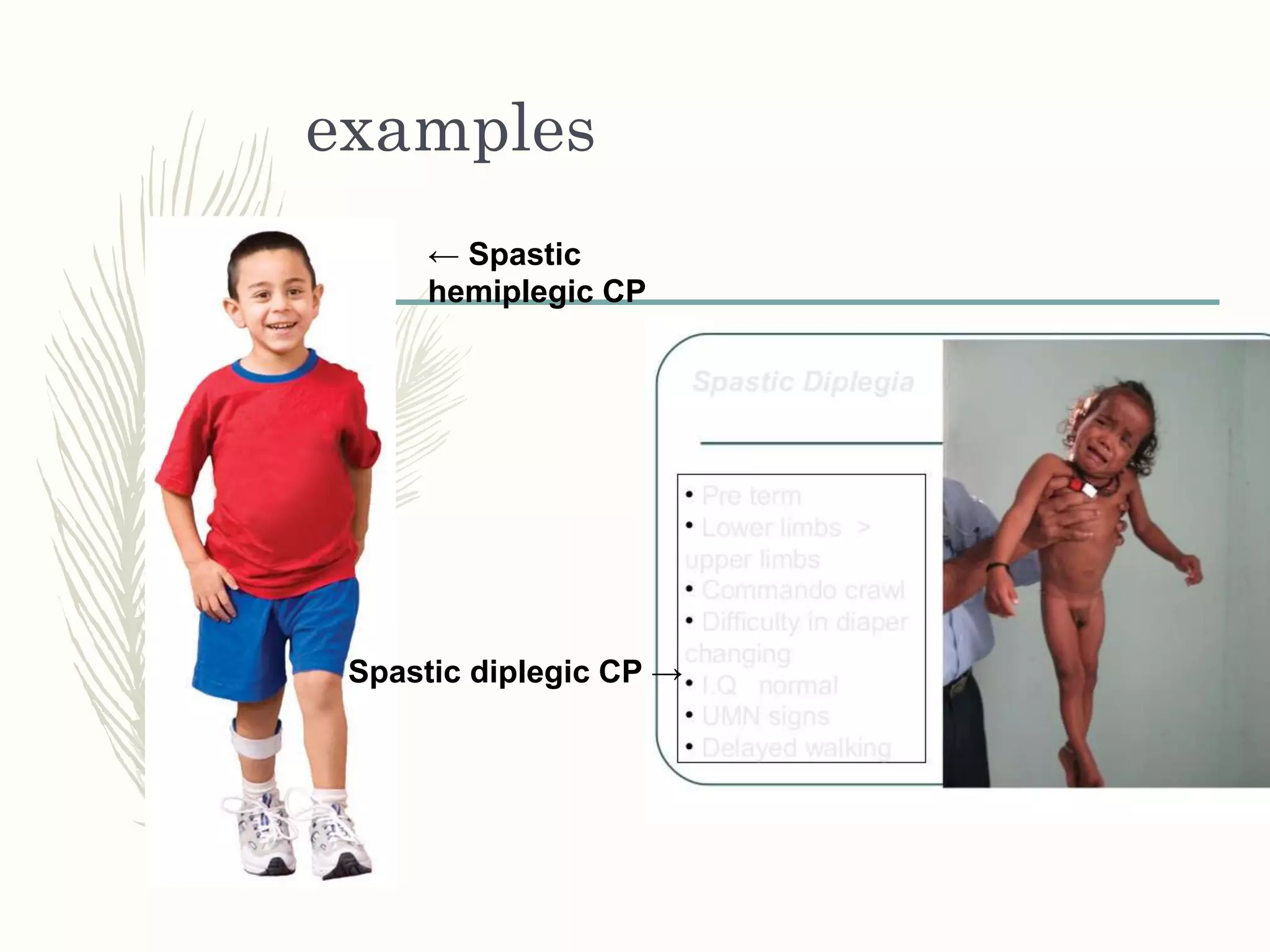 Cerebral Palsy in Children | PPTX