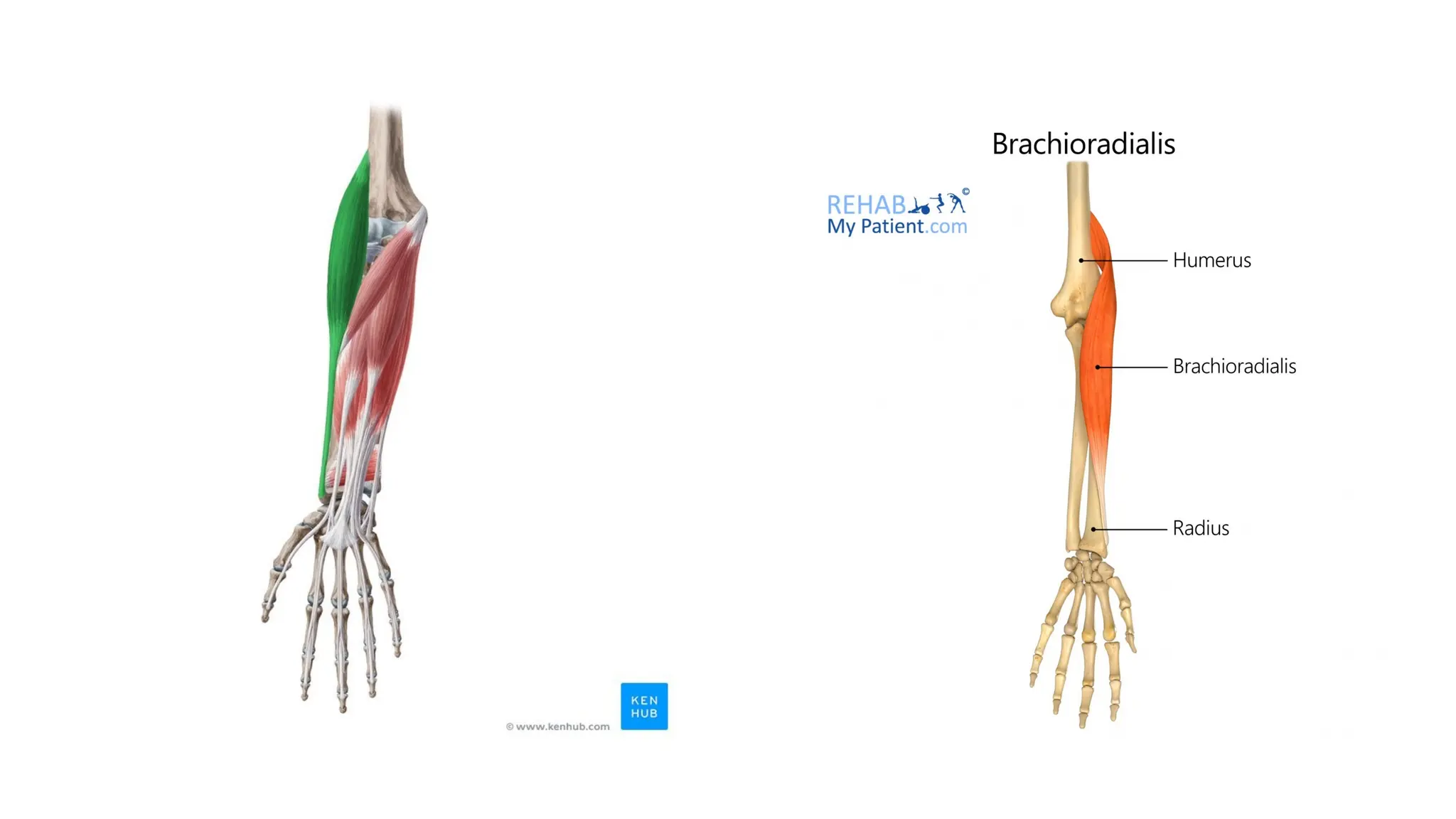 21 The lateral muscle of forearm ........ | PPTX