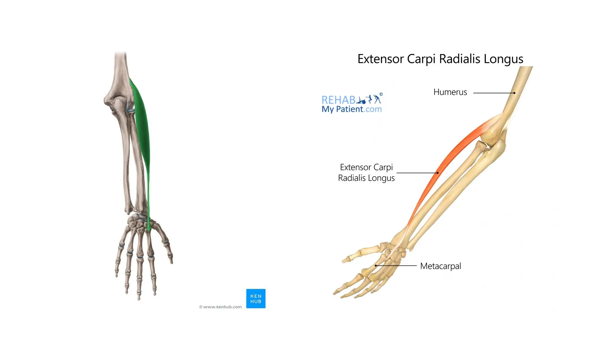 21 The lateral muscle of forearm ........ | PPTX