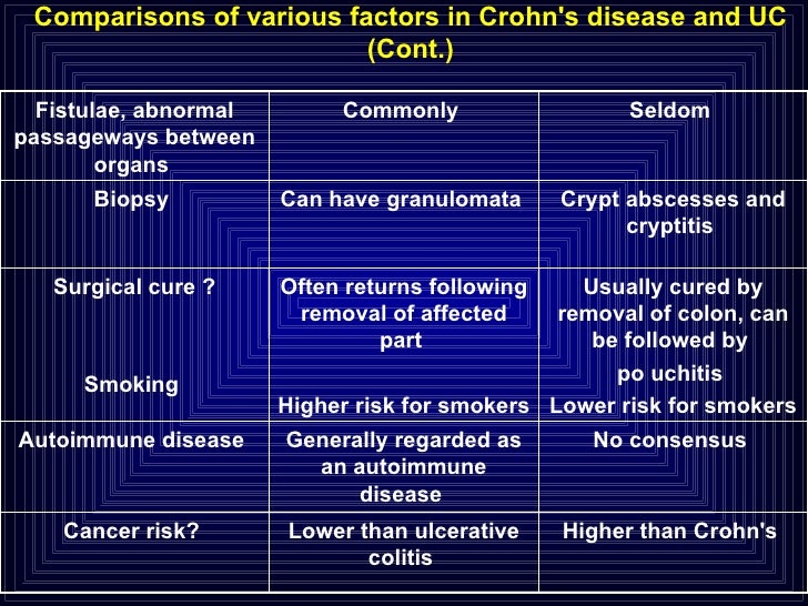 21 ulcerative colitis