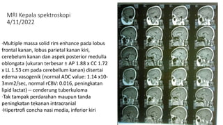 22-01-2022 TUBERKULOMA.pptx