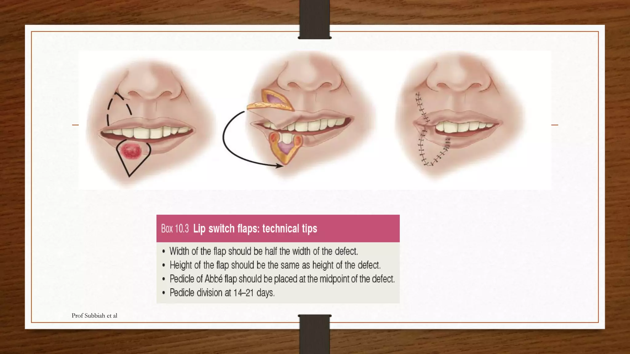 LIP RECONSTRUCTION ppt.pptx | Ear, Nose and Throat Conditions ...
