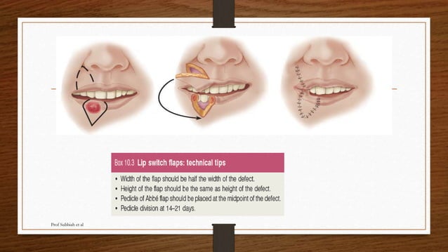 LIP RECONSTRUCTION ppt.pptx | Ear, Nose and Throat Conditions ...