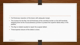 LIP RECONSTRUCTION ppt.pptx