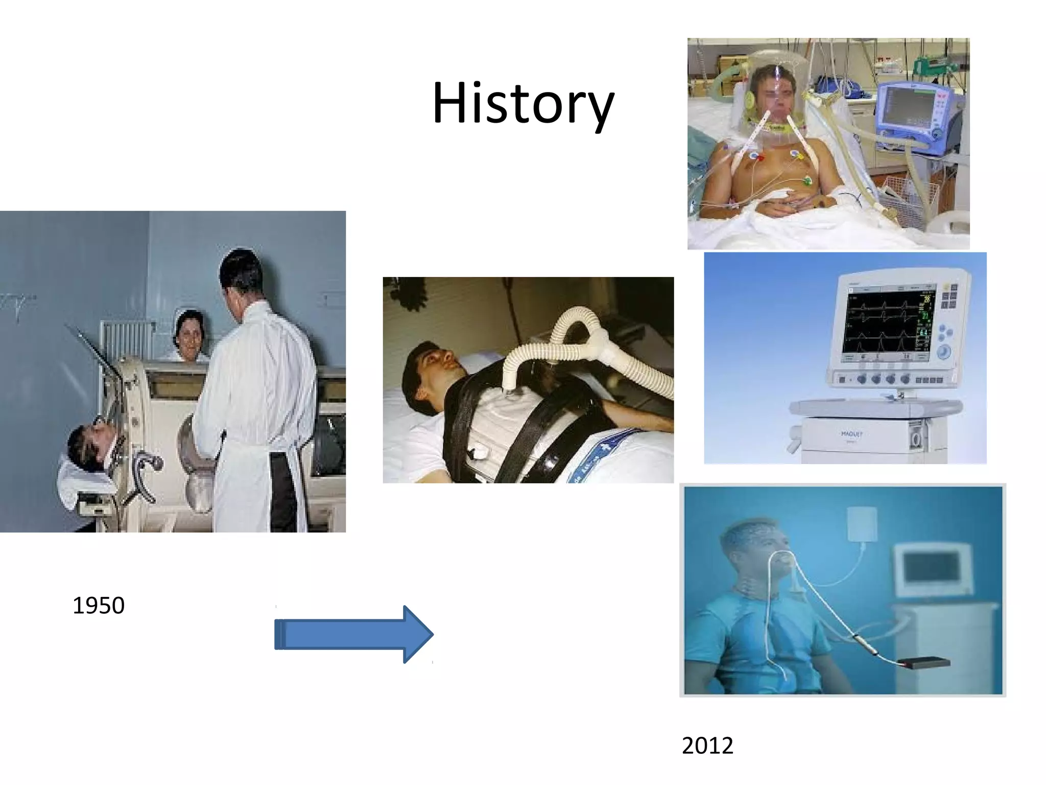 22 09-12 how do i ventilate normal lung | PPT