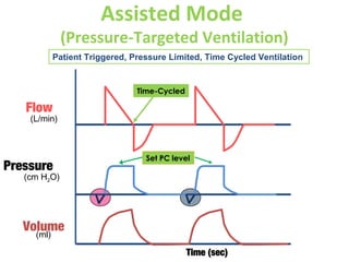 22 09-12 how do i ventilate normal lung | PPT