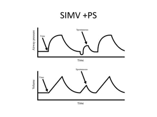 22 09-12 how do i ventilate normal lung | PPT