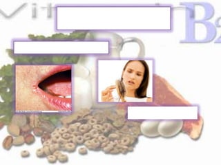 vitamin B2 | PPTX