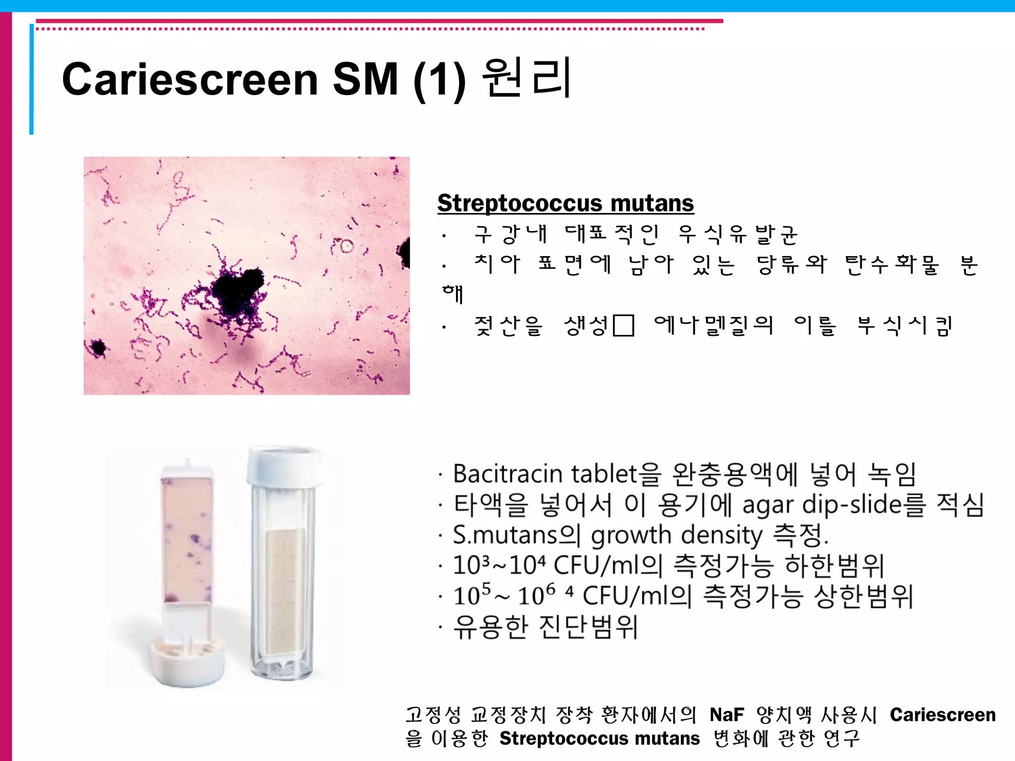 22 김현민 우식활성검사 | PPT