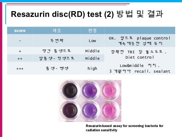 22 김현민 우식활성검사