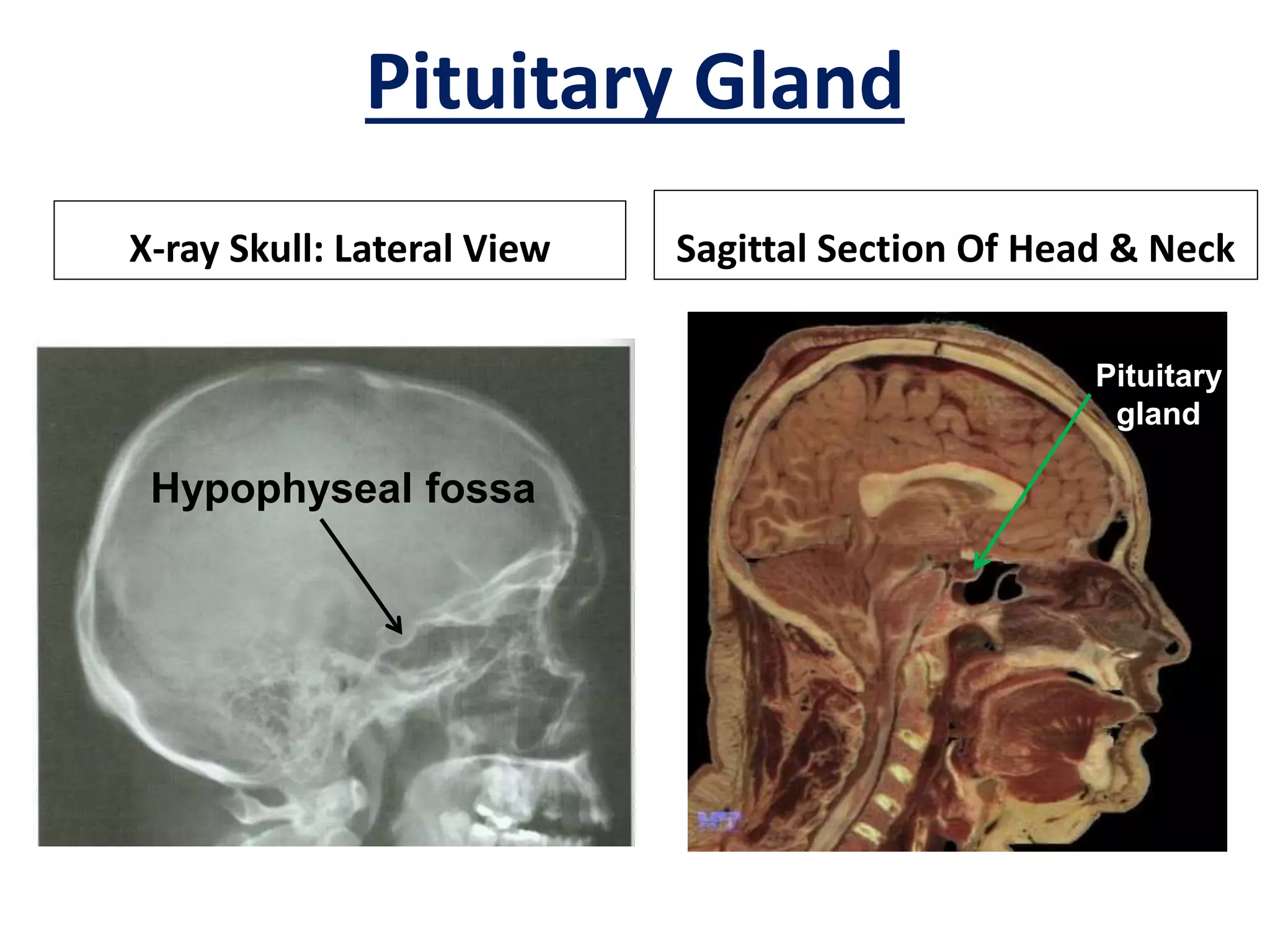 Histology of endocrine glands | PPTX