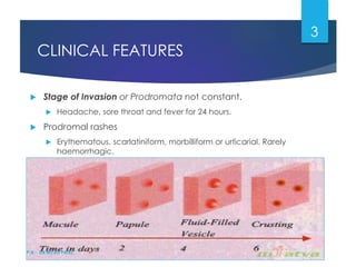 22.CHICKEN POX.pdf