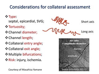 Imre Ungi: Best angiographic projection for collateral analysis | PPT