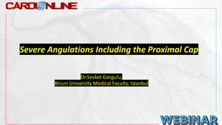 Sevket Görgülü: Severe angulations including the proximal cap | PPT
