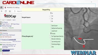 Sevket Görgülü: Severe angulations including the proximal cap | PPT