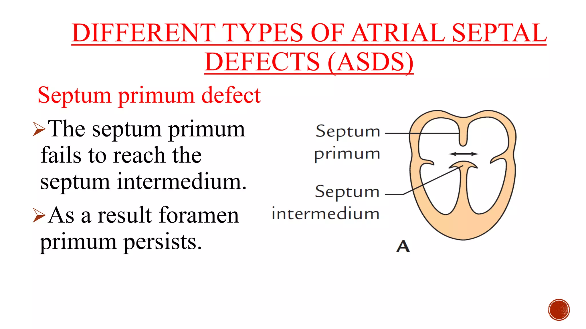22. Development of Interatrial and Interventricular septum 2020.pdf