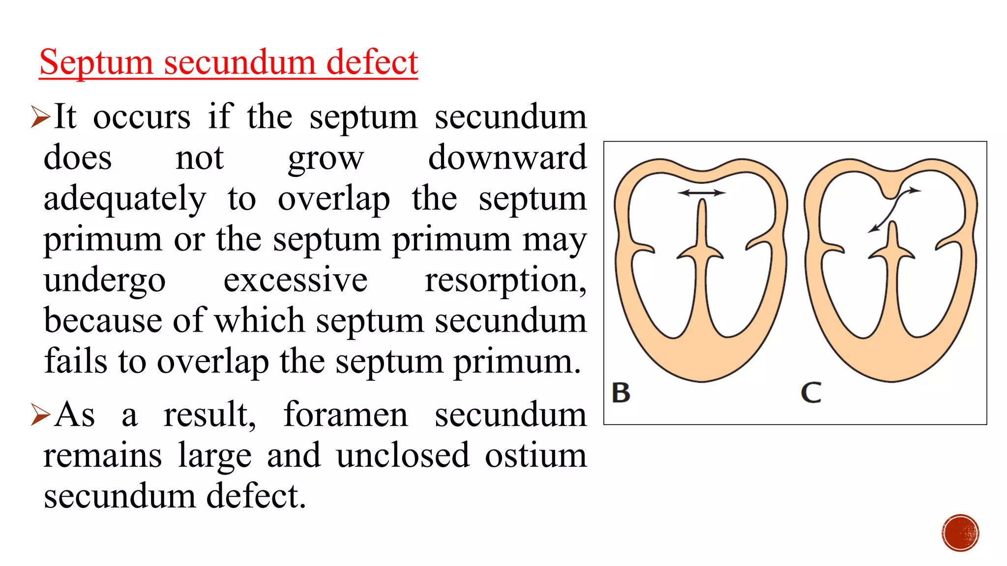 22. Development of Interatrial and Interventricular septum 2020.pdf