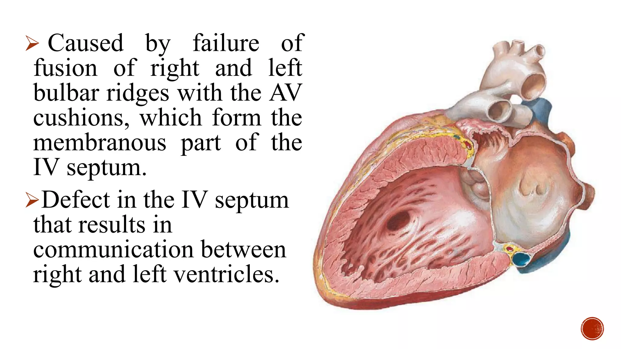 22. Development of Interatrial and Interventricular septum 2020.pdf