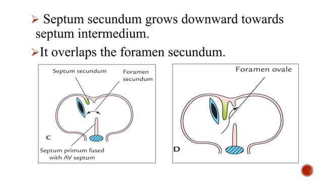 22. Development of Interatrial and Interventricular septum 2020.pdf ...