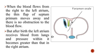 22. Development of Interatrial and Interventricular septum 2020.pdf