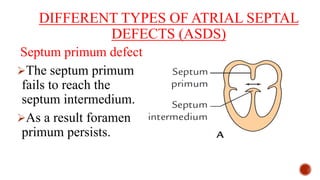 22. Development of Interatrial and Interventricular septum 2020.pdf ...